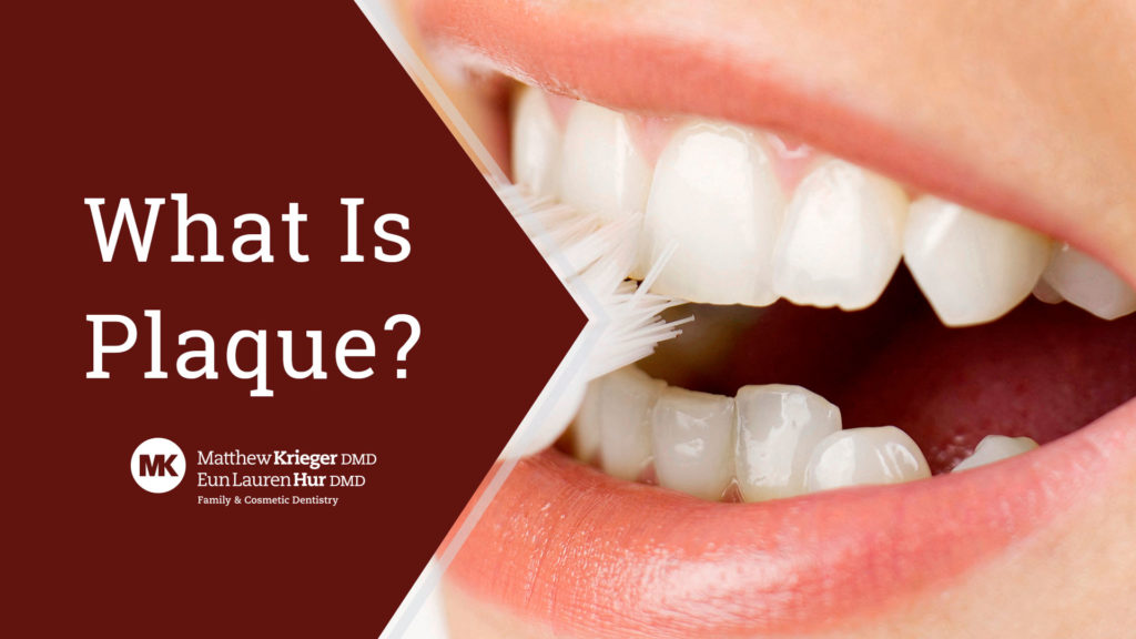 what-is-plaque – Matthew Krieger DMD